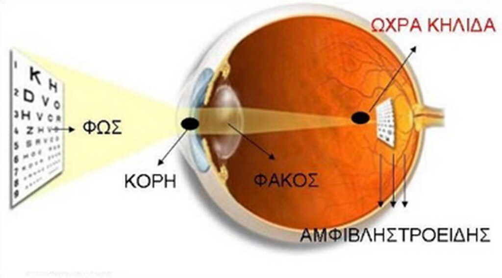 Ωχρά Κηλίδα - Οφθαλμίατρος Θεσσαλονίκη | Βασάκος Δημήτριος